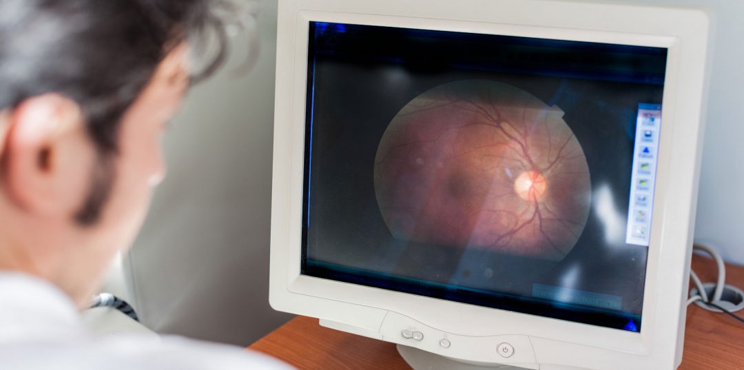 Optomap - A to Z Eye Care